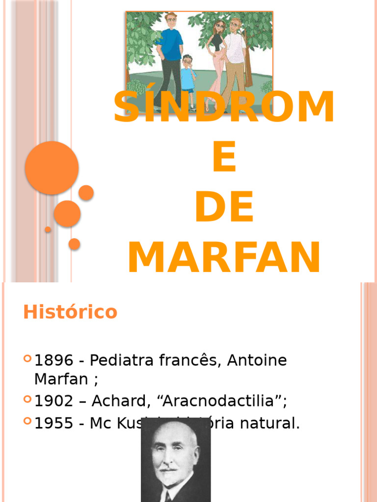 Síndrome de Marfan | PDF