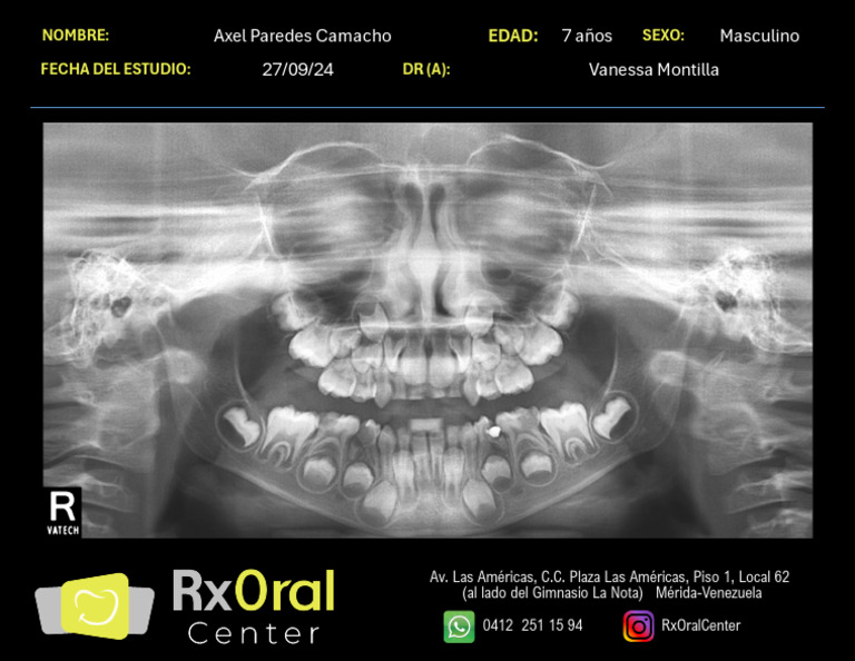 Axel Paredes Camacho PANORAMICA | PDF