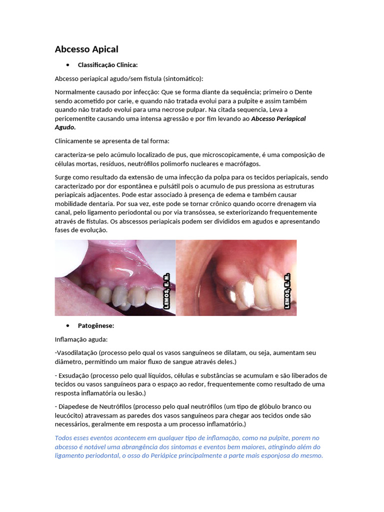 Abcesso Apical | PDF