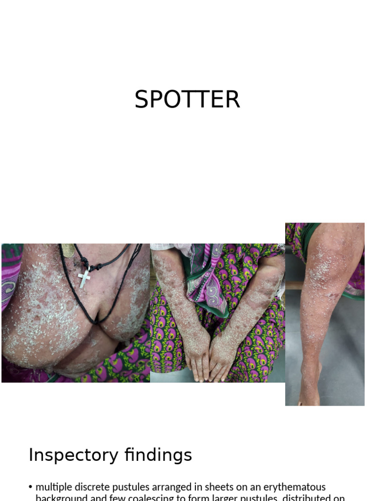 Spotter | PDF