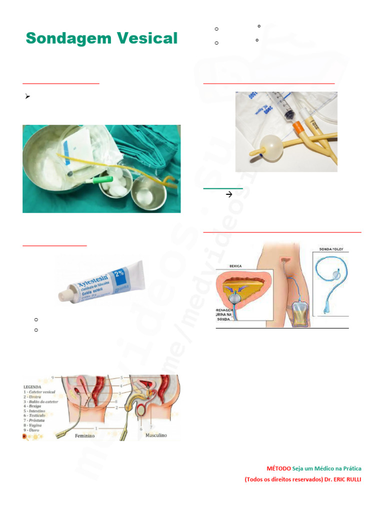 Procedimentos Sondagem Vesical | PDF