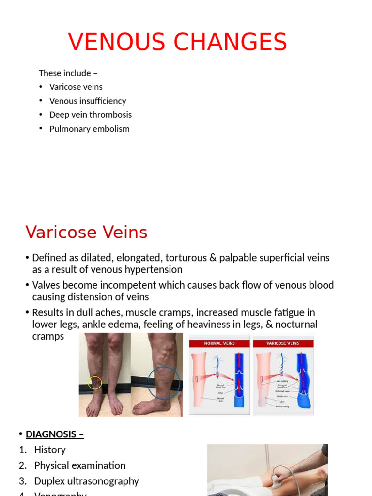Venous Changes | PDF
