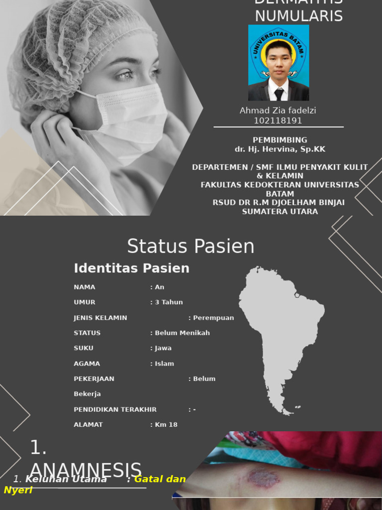 Lapkas Dermatitis Numularis | PDF