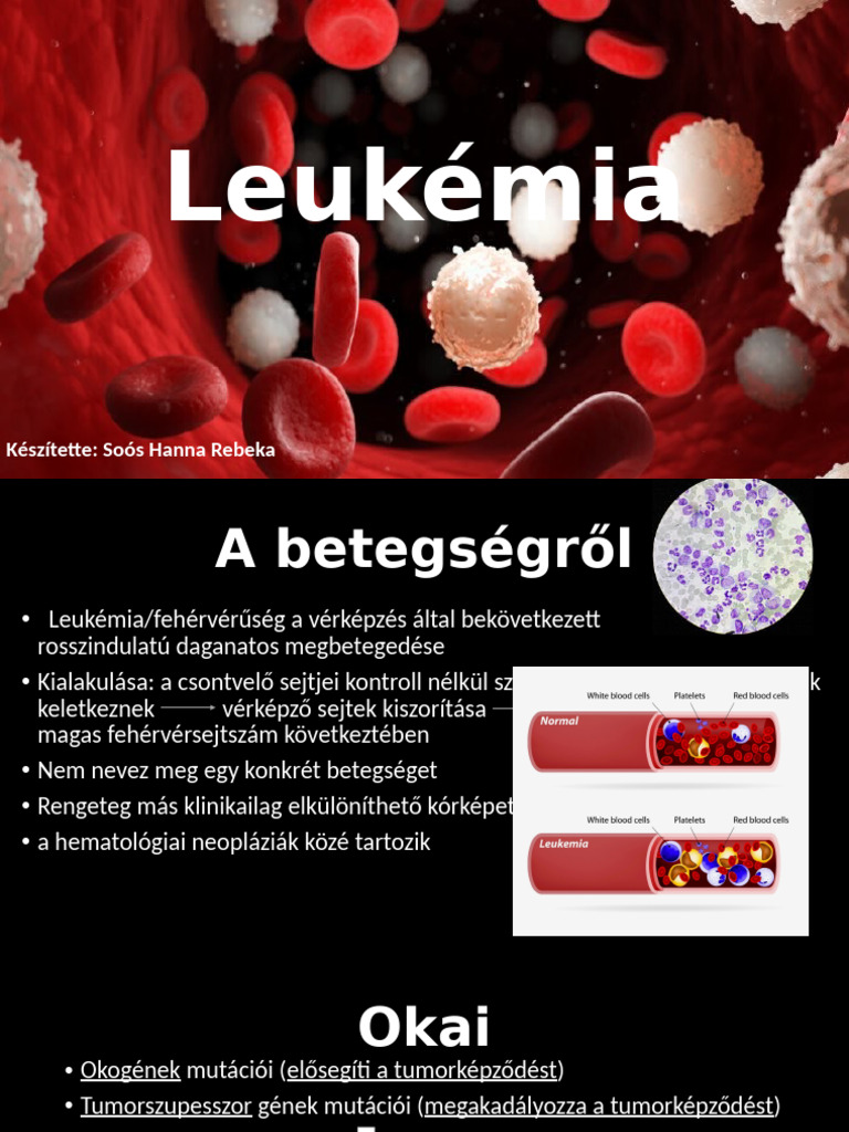 Leukémia | PDF