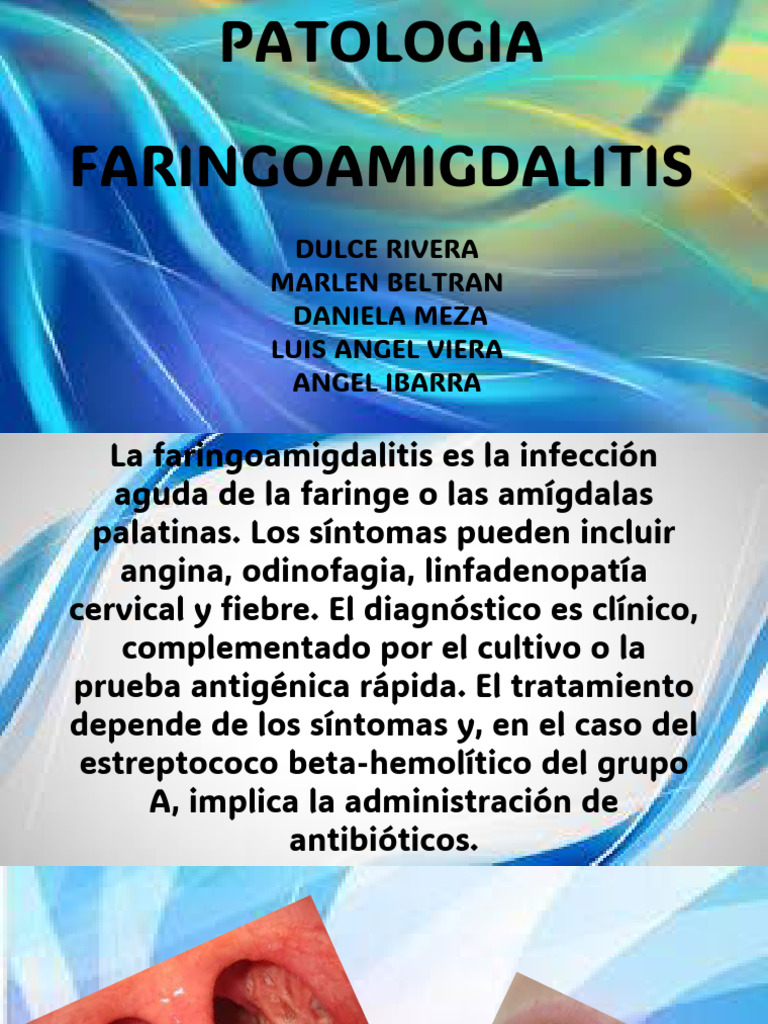 FARINGOAMIGDALITIS | PDF