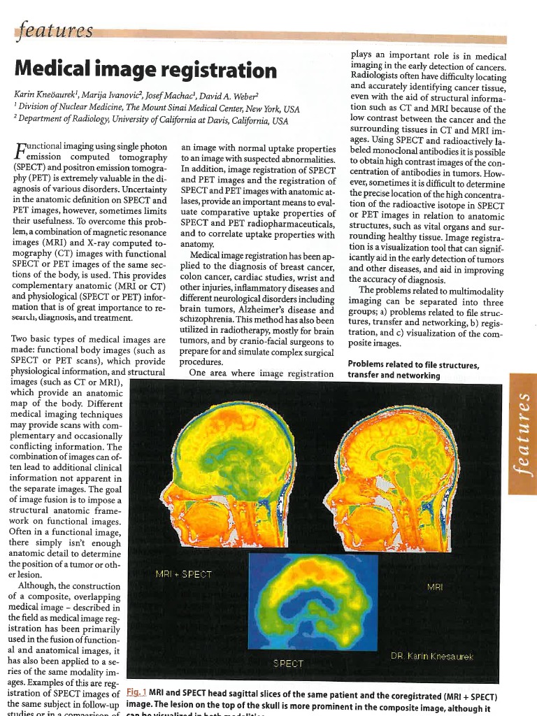 Features: Medical Image Registration | PDF | Medical Imaging | Positron ...