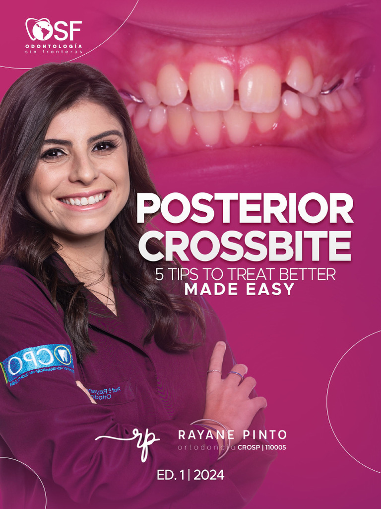 Posterior Crossbite 5 Tips To Treat Better - Made Easy | PDF