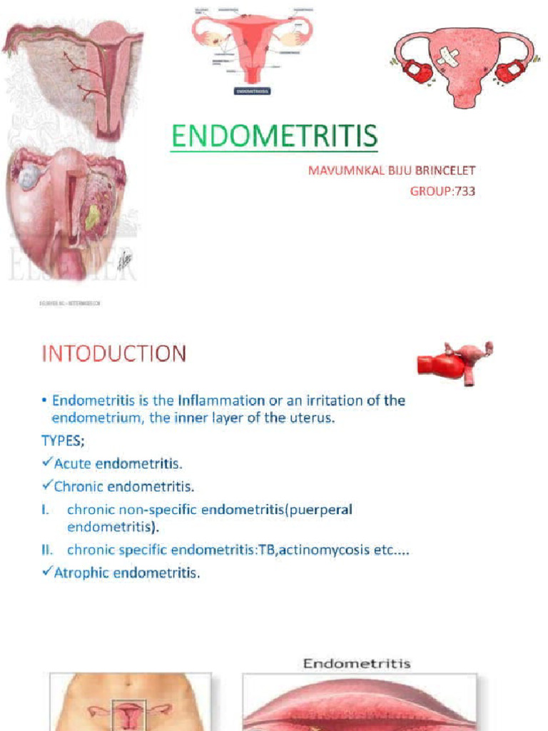 Endometritis Obstetric and Gynecology | PDF