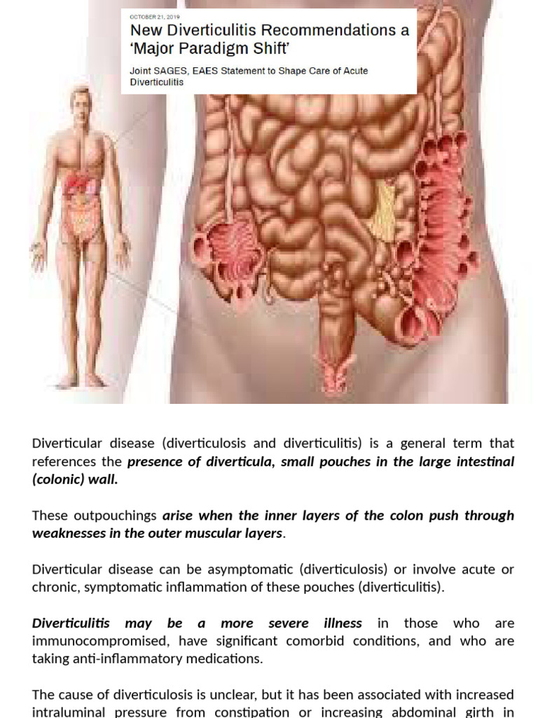 2019 Consensus guideline for Acute diverticulitis | PDF