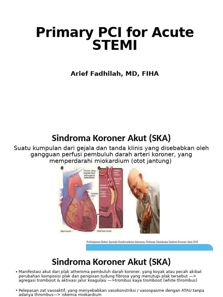 Ppci In Stemi Phbb Pdf