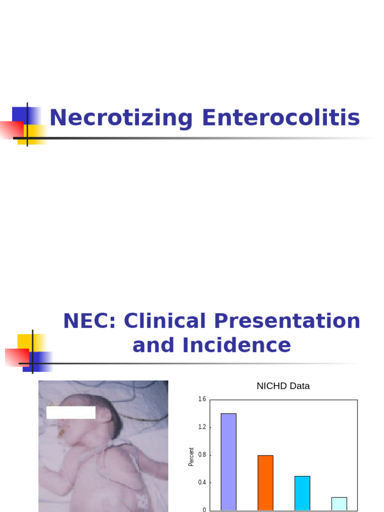 Necrotizing Enterocolitis | PDF