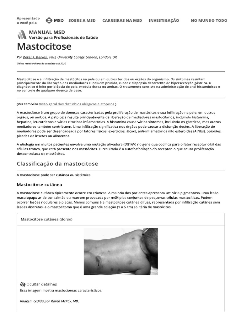 Mastocitose | PDF