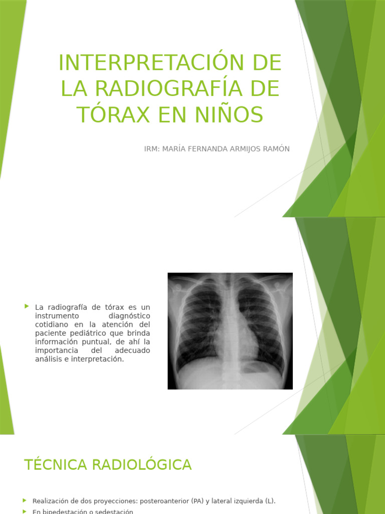 Interpretación de La Radiografía de Tórax en Niños | PDF | Pulmón | Especialidades Medicas