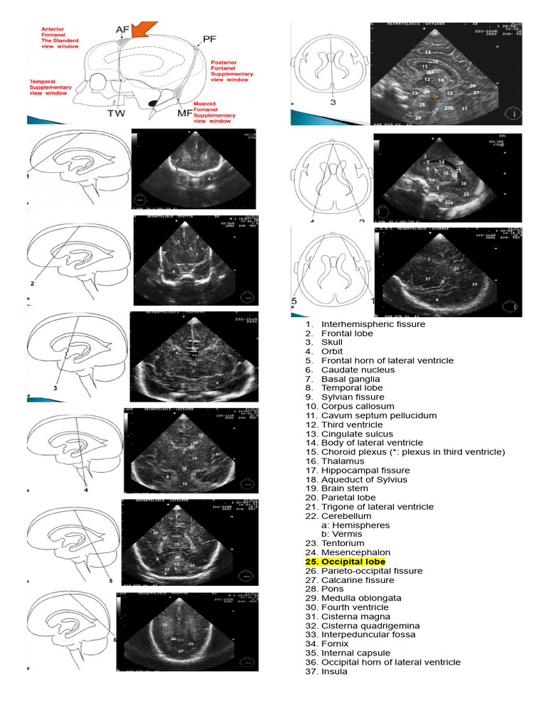 Brain Ultrasound | PDF