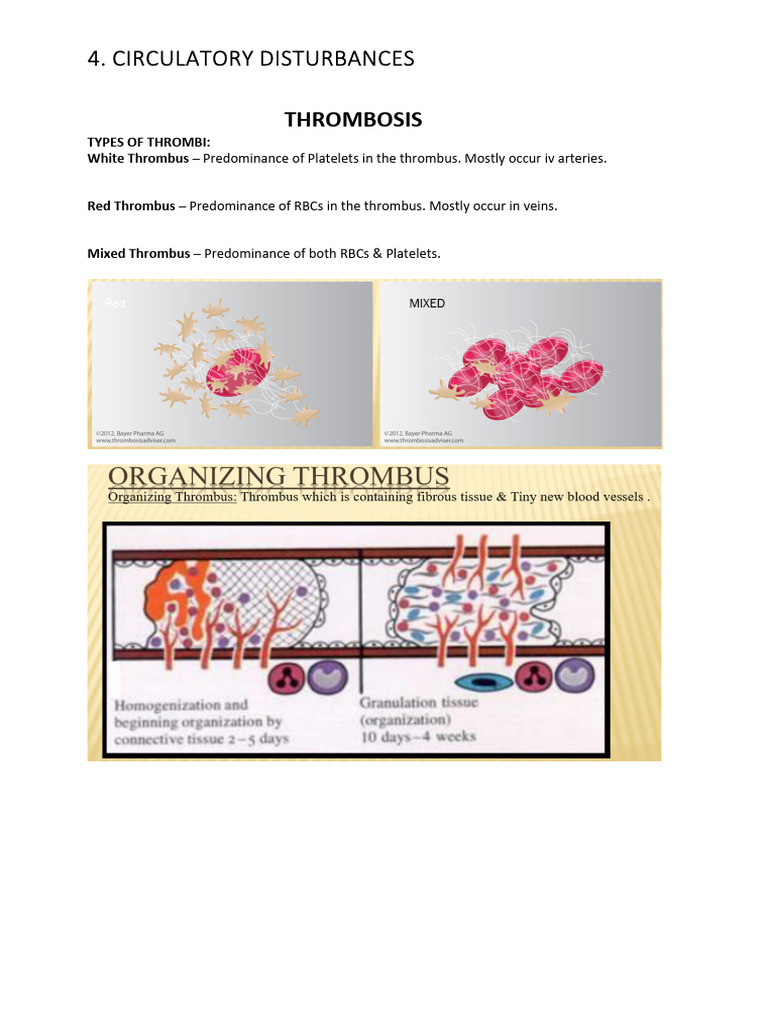 Circulatory Disturbances | PDF