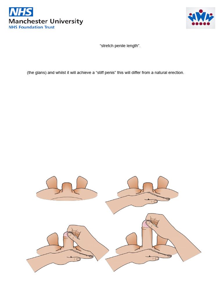 How To Estimate Your Stretch Penile Length | PDF