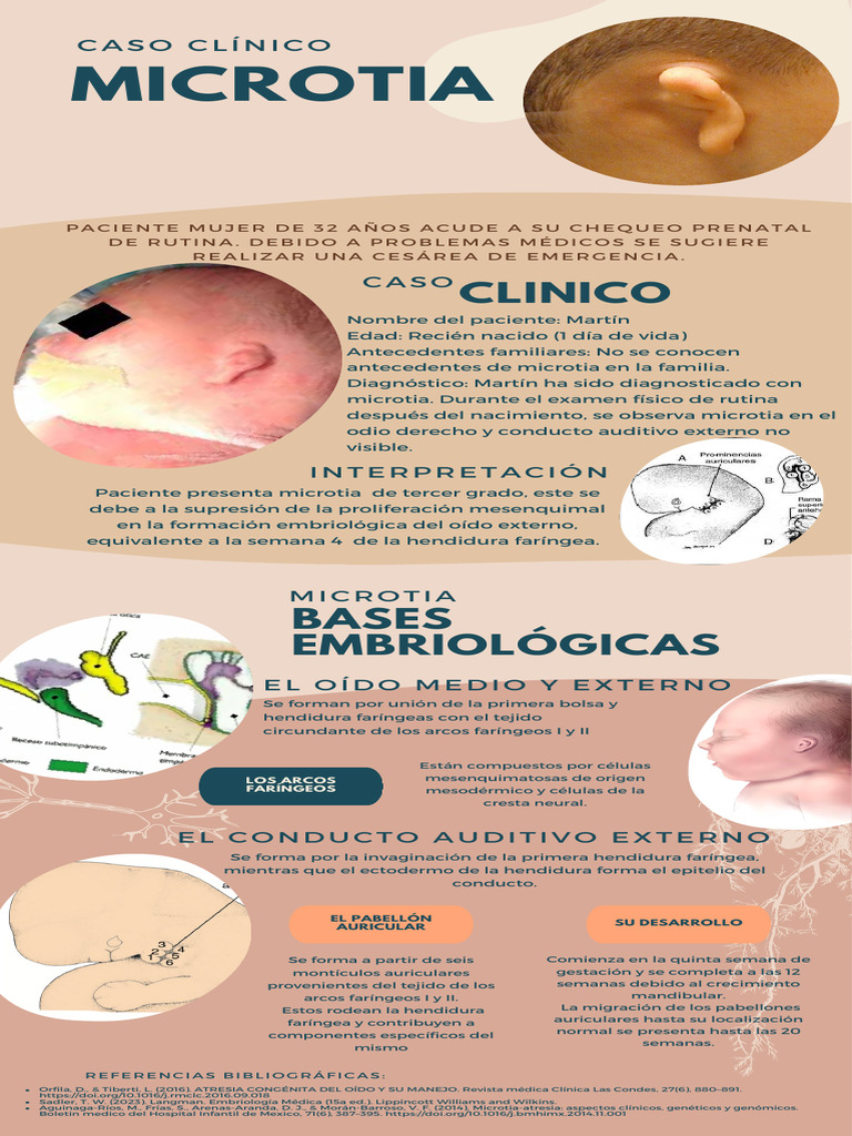 Microtia | PDF | Anatomía | Especialidades Medicas