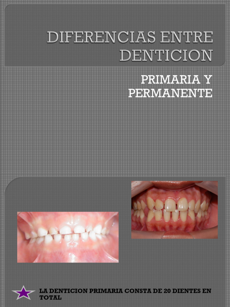 Diferencias Entre Denticion | PDF