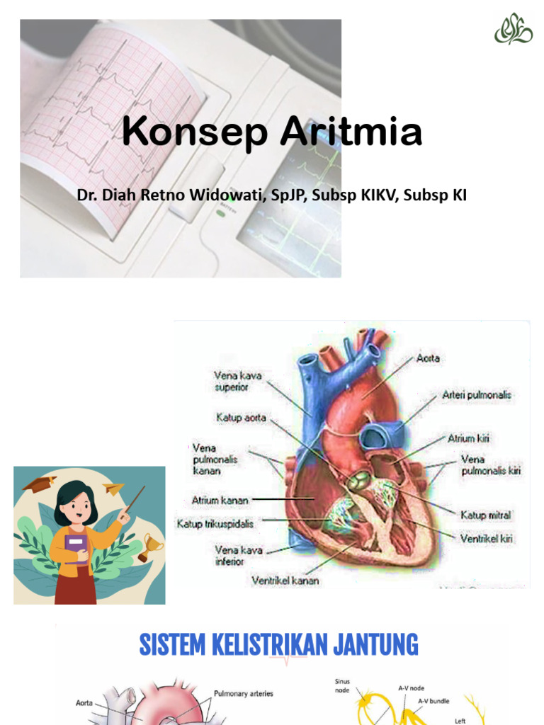 Konsep Aritmia DRW | PDF