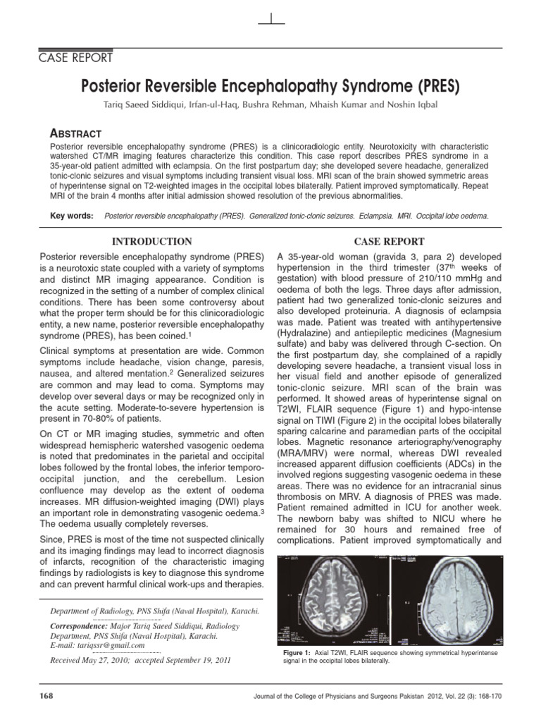 Posterior Reversible Encephalopathy Syndrome (PRES) : Case Report | PDF