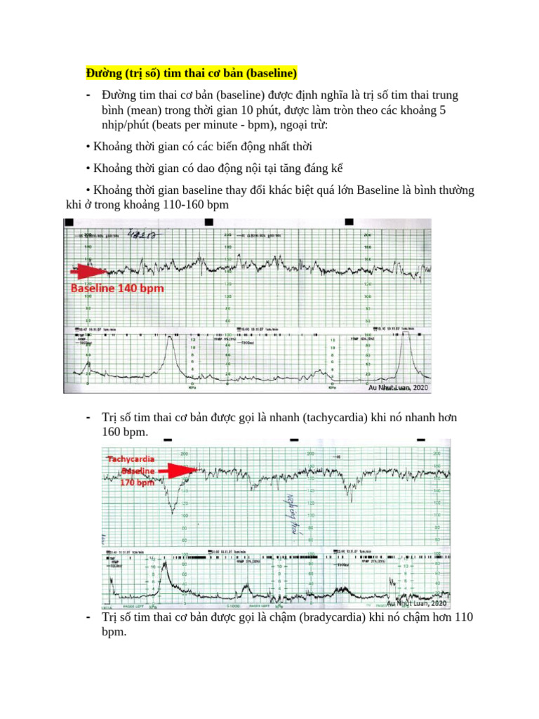 Đọc baseline | PDF