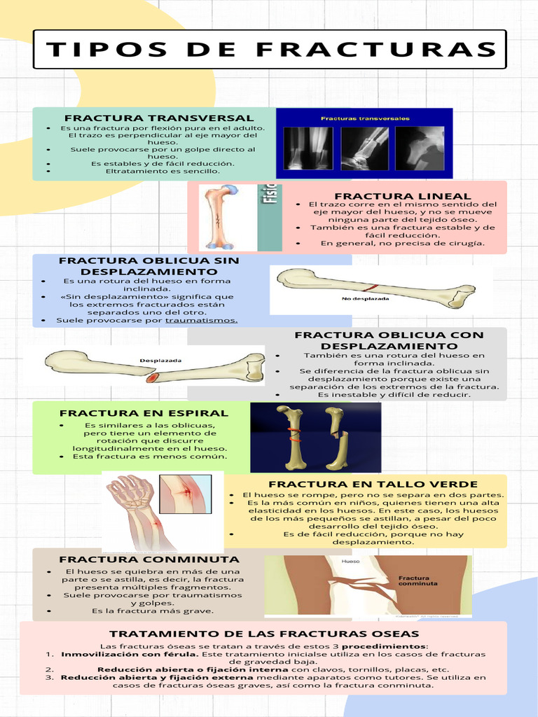 Tipos de Fracturas | PDF | Hueso | Fractura