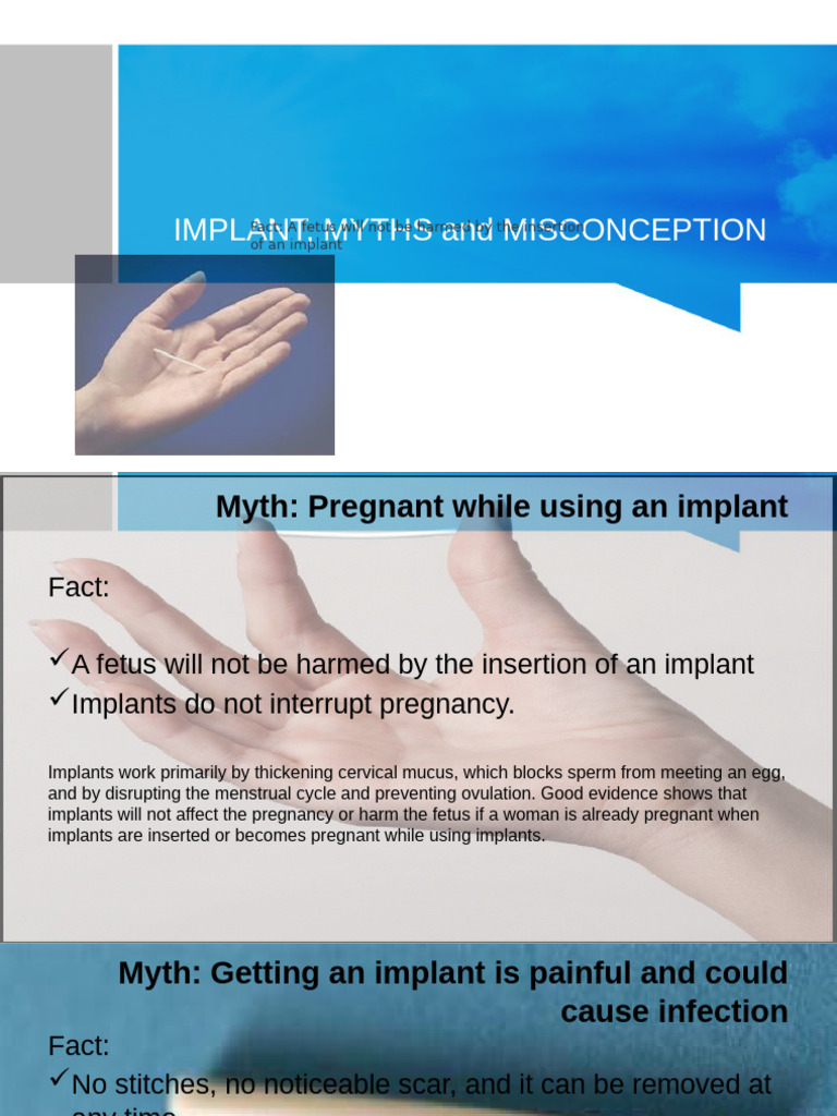 Implant | PDF