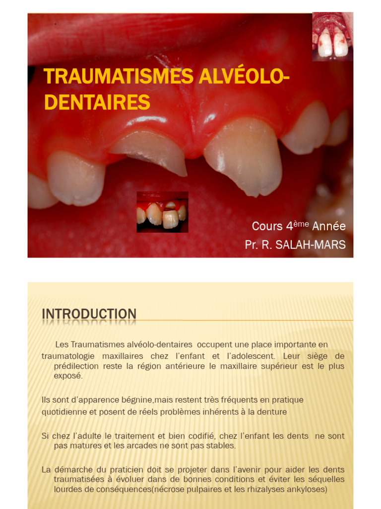 1 - Les Traumatismes Alvéolo-Dentaires | PDF