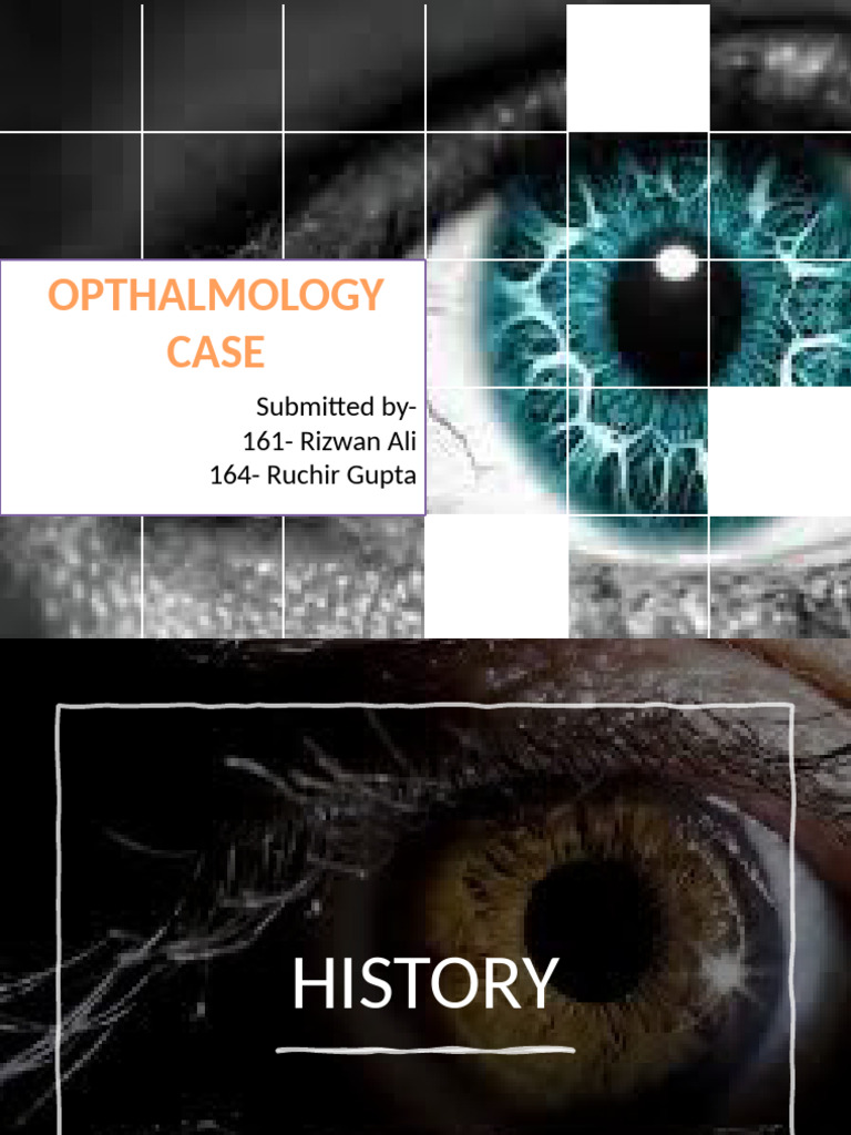 Opthal Case Presentation-1 | PDF
