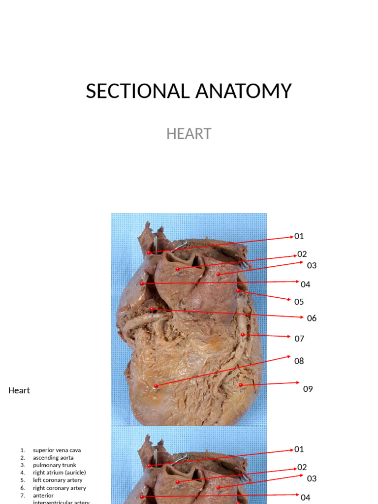 SECTIONAL ANATOMY - HEART With Answers | PDF