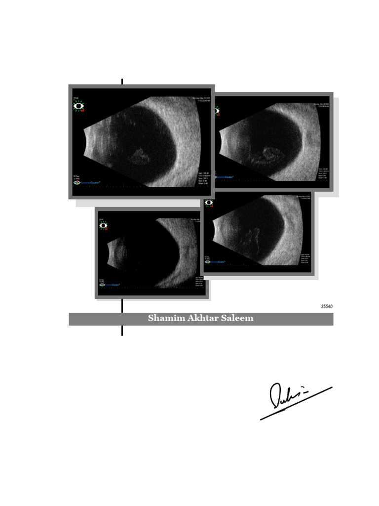 Shamim Akhtar Saleem | PDF