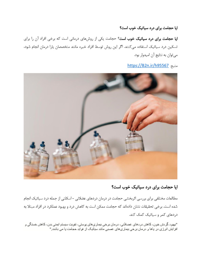 Is Cupping Good for Sciatica | PDF