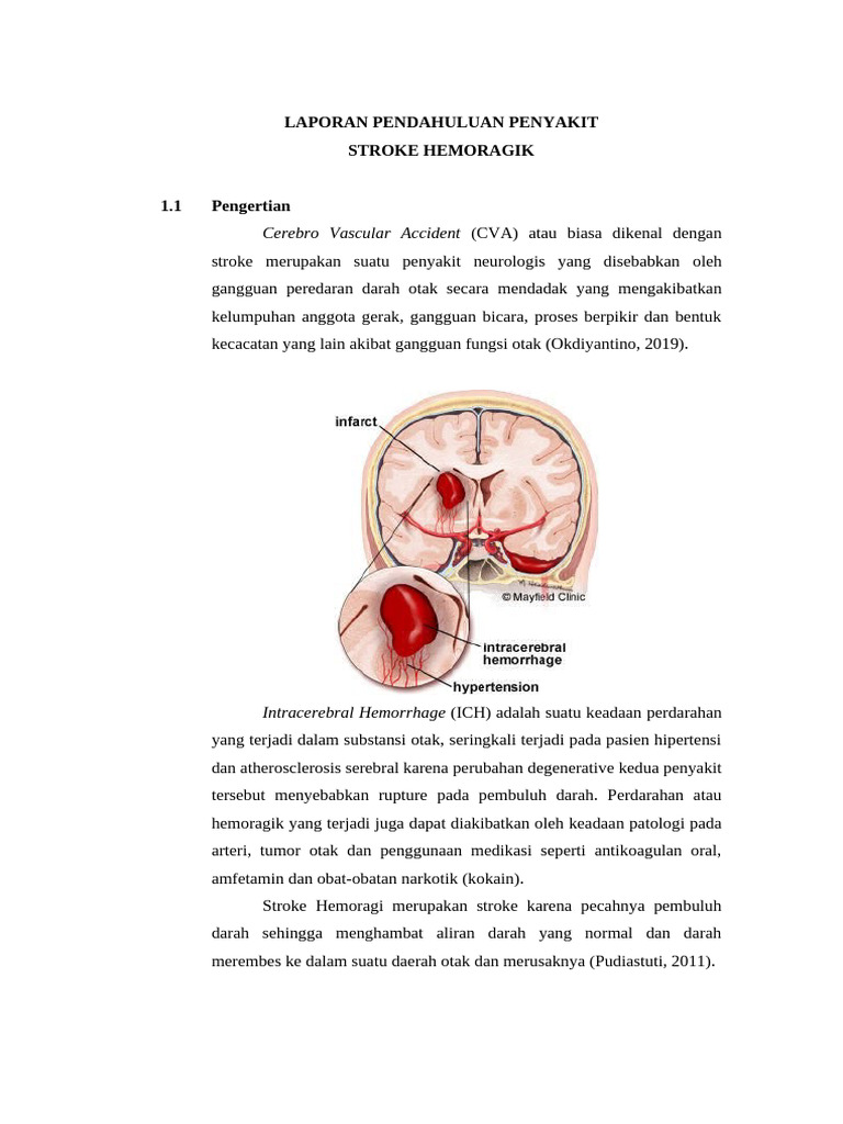 1 Laporan Pendahuluan Stroke Hemoragik | PDF