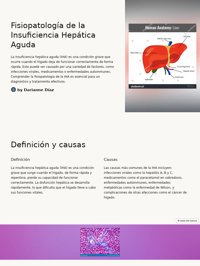 Fisiopatologia de La Insuficiencia Hepatica Aguda | PDF
