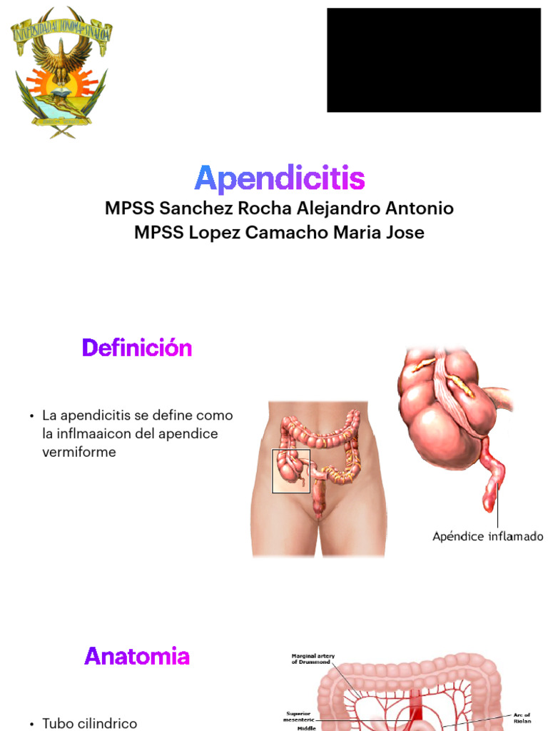 Apendicitis | PDF
