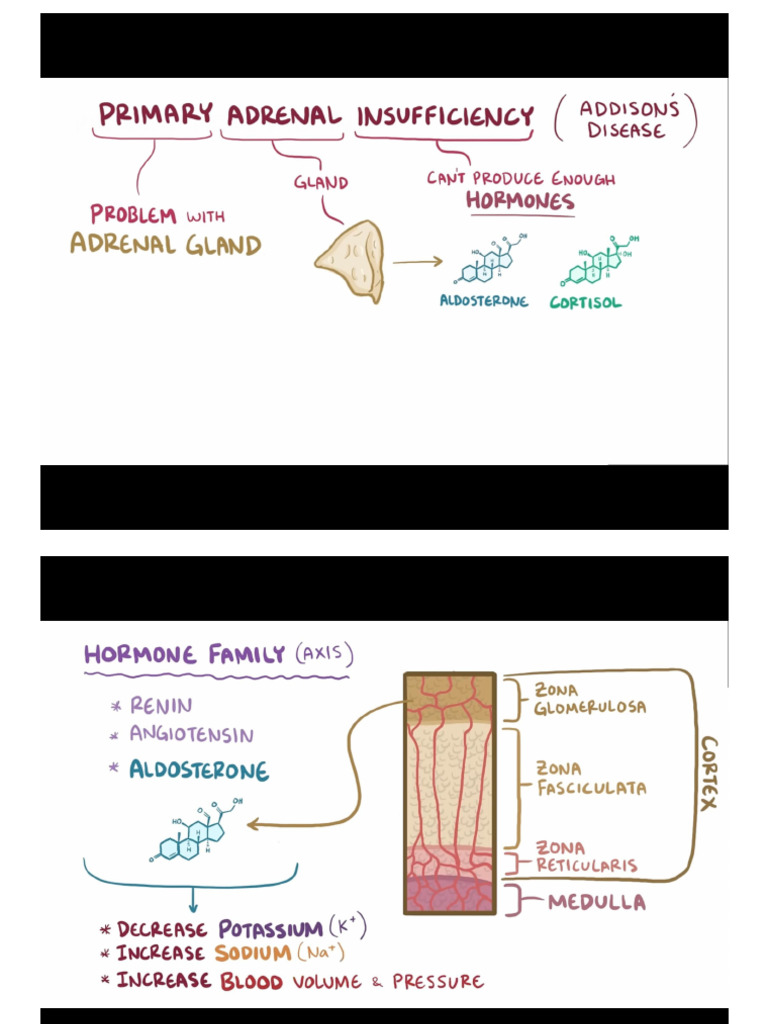 Addison disease | PDF