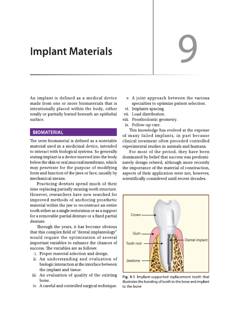 Implants | PDF