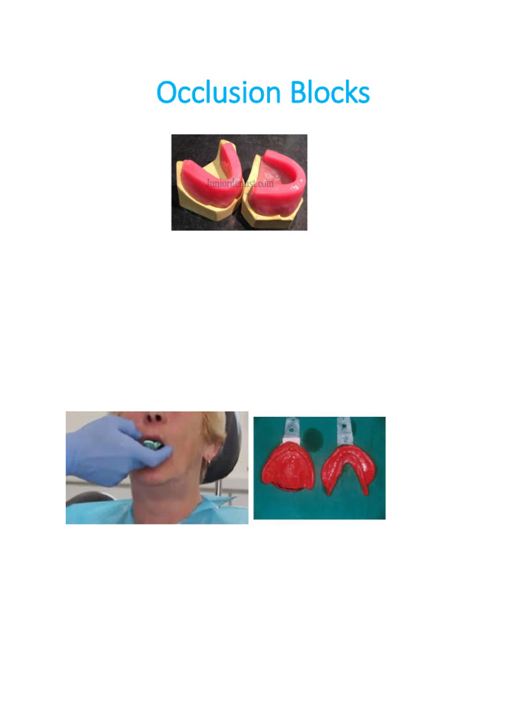 Occlusion Blocks | PDF