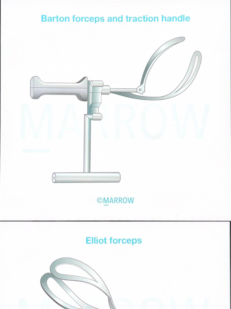 Obs Forceps | PDF