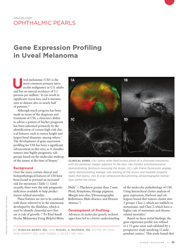 July 2017 Ophthalmic Pearls Gene Expression Profiling in Uveal Melanoma | PDF
