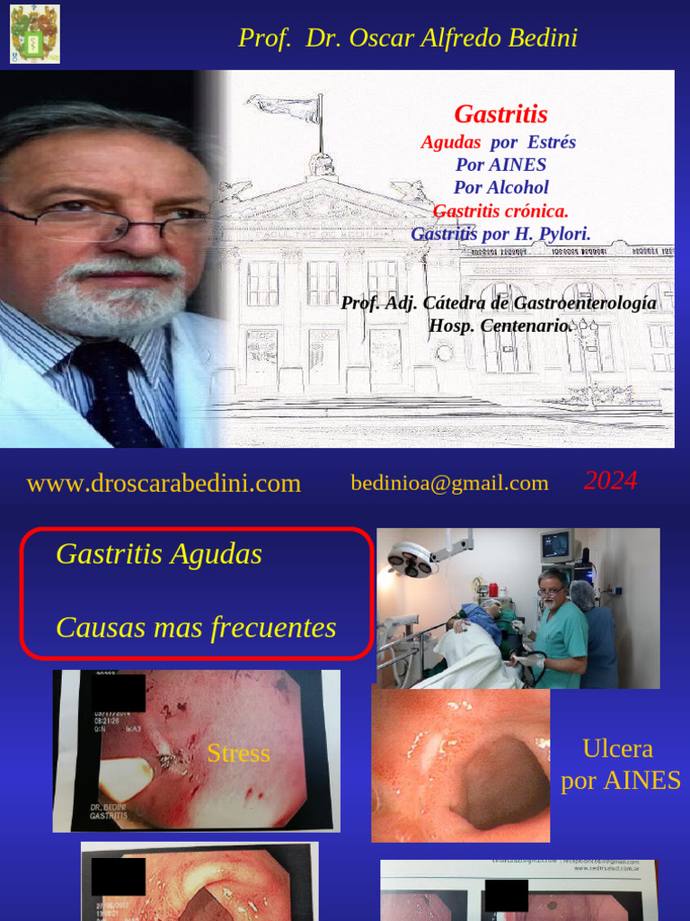 Gastritis 2024 Sala 7 PDF
