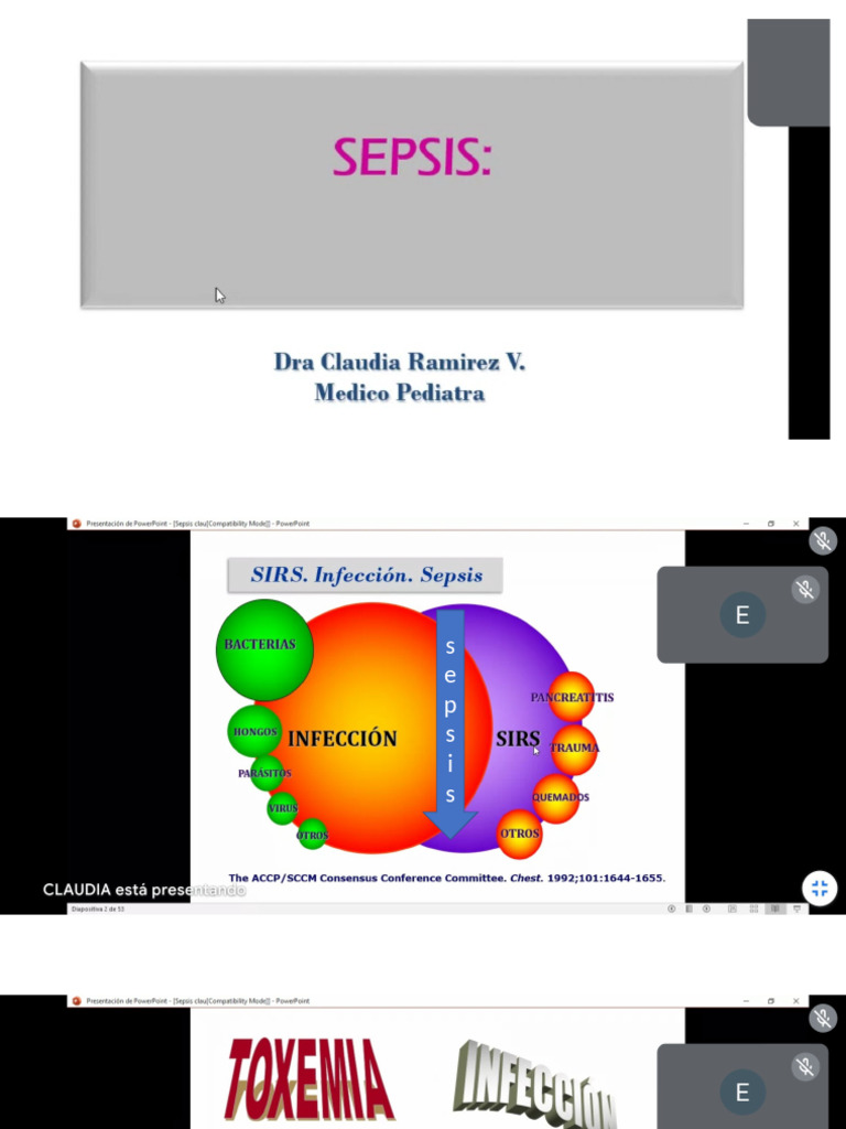 SEPSIS | PDF