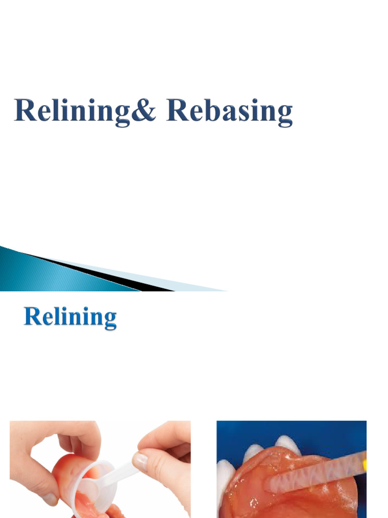 Removable Lec9 | PDF