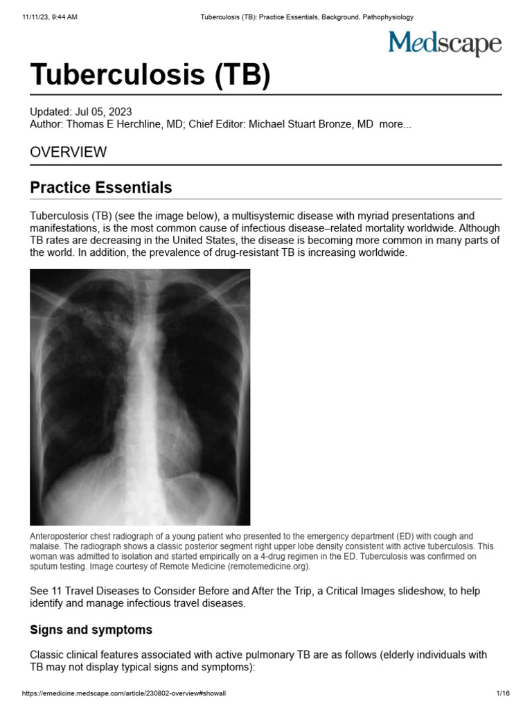 Tuberculosis_TB_Practice_Essentials,_Background,_Pathophysiology | PDF