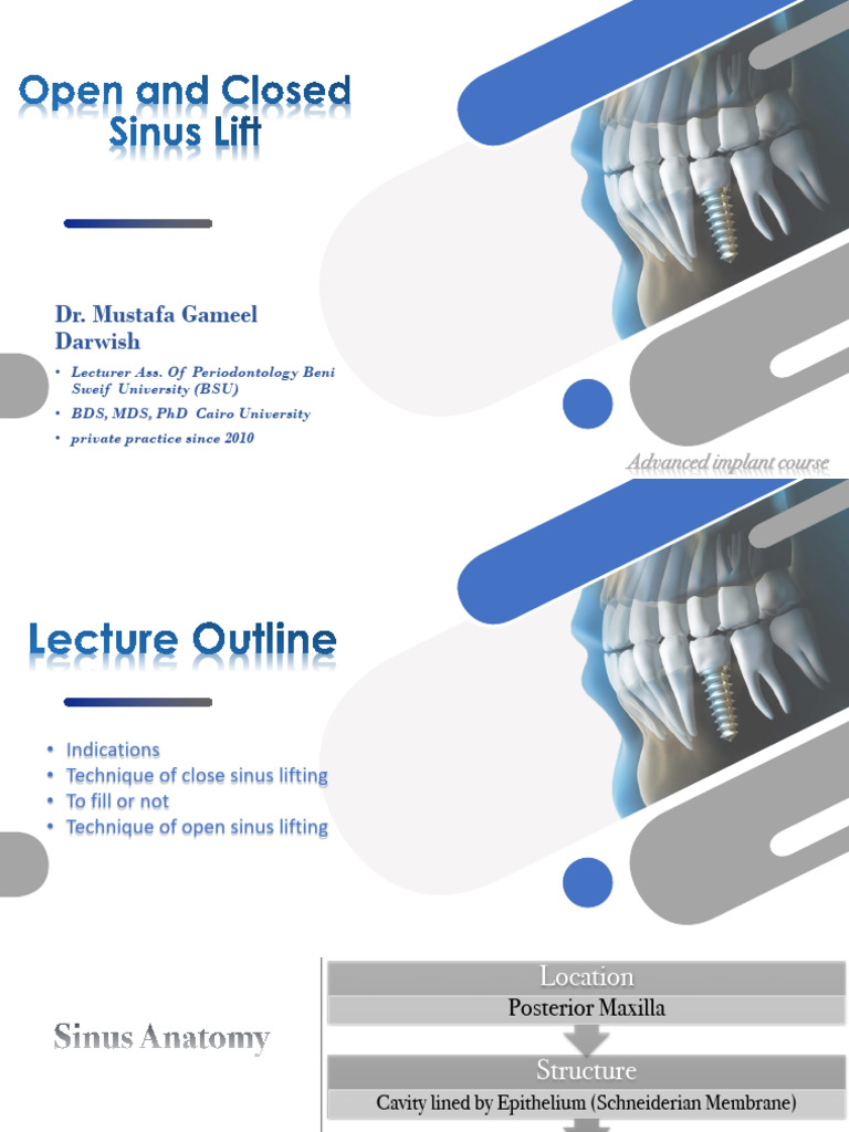 Open and Closed Sinus Lifting | PDF
