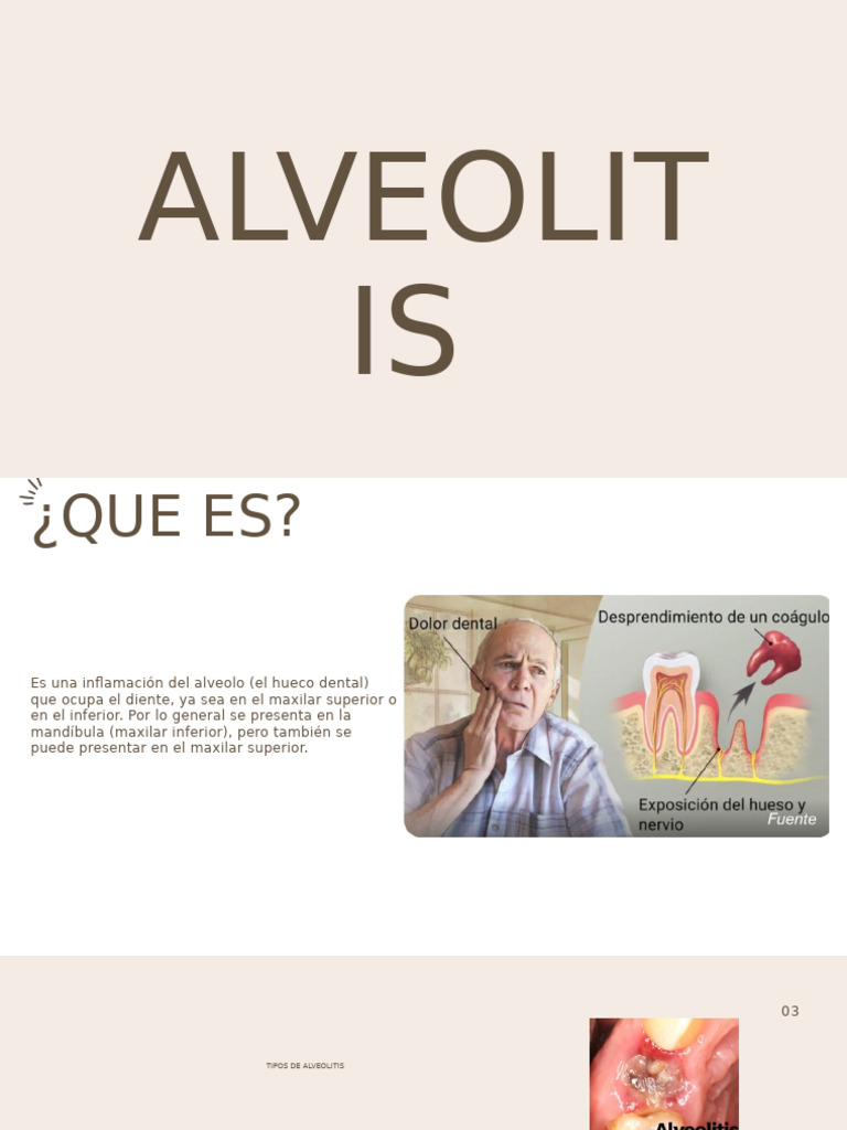 Alveolit IS | PDF