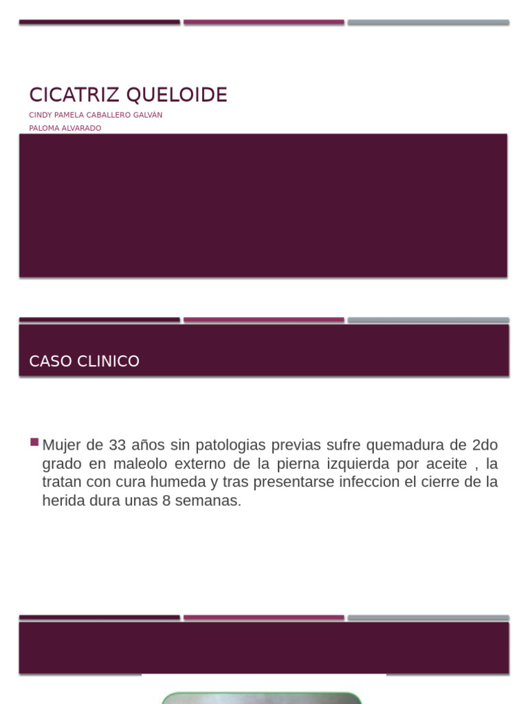 Cicatriz Queloide | PDF