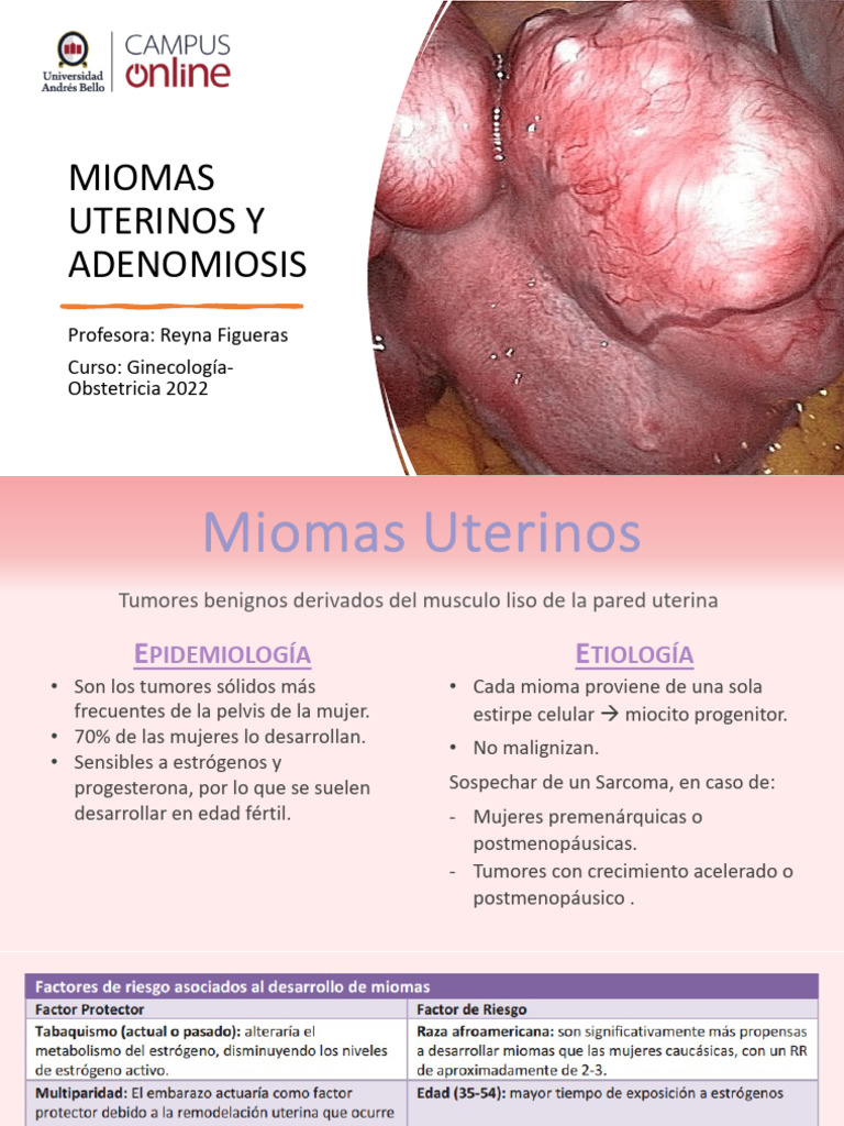 Miomas Uterinos y Adenomiosis | PDF