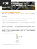 Triada Terrible del Codo: Diagnóstico y Tratamiento | PDF | Codo ...