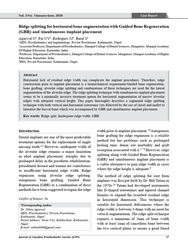 Ridge Splitting For Horizontal Bone Augmentation With Guided Bone ...
